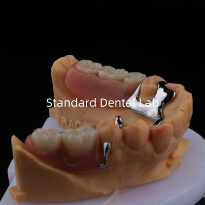 China Alloy Metal Partial Denture Framework 3 Shape Exocad Laser Printing Lower Cast Partial Finish for sale