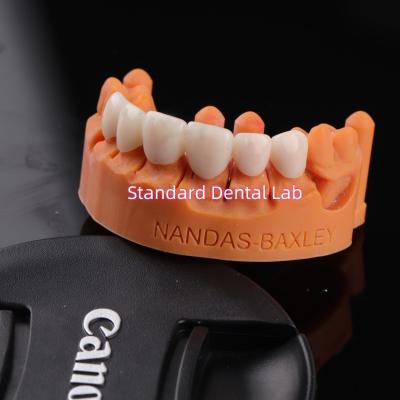 China Comfort and Function with Digital CAD CAM Dental Lab Translucent Layered Zirconia Bridge for sale