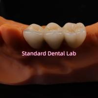 China Digital CAD CAM Dental Lab Crowns Translucent Layered Zirconia Crown for sale