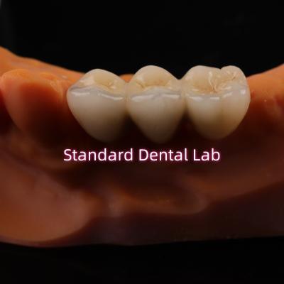 China Digital CAD CAM Dental Lab Crowns Translucent Layered Zirconia Crown for sale