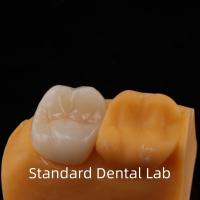 China 5-Year Guarantee Full Contour Zirconia Crown for Molar Teeth Noritake Porcelain Made in by Trusted Dental Laboratory for sale