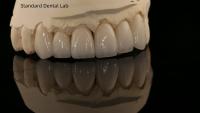 China Full Contour Zirconia Crown and High Aesthetic Natural Dental Bridge 5 Year Guarantee for sale