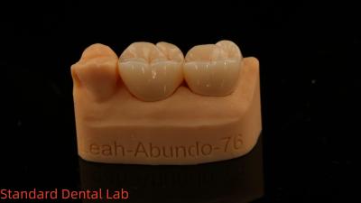 China Solid Dental Lab Crowns 3D Pro High Translucency Full Zirconia Crowns with 5-Year Guarantee for sale