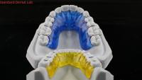 China Comfortable Stainless Steel Acrylic Hawley Retainer Effective Orthodontics Appliance for sale