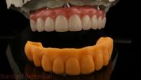 China 5 Year Guarantee Dental Implant Crown PMMA Bridge Over Multi Unit Abutments Customized Vita Shade for sale