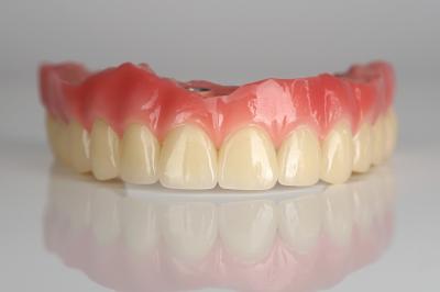 China Full Arch Zirconia Implant Bridge All-On-Four / All On Six Dental Implants Fast Recovery for sale