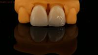 China 5 Year Guarantee Full Contour Zirconia Crown Customized Vita Shade High Aesthetic Natural Dental Bridge for sale