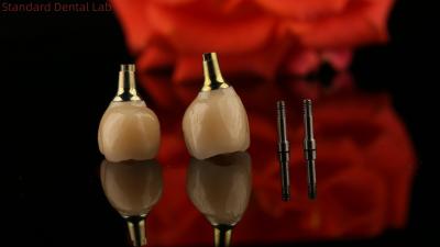 China Porcelain Zirconia Cement Retained Screw Implant Hexagonal Head Shape for Custom Fit Esthetics for sale
