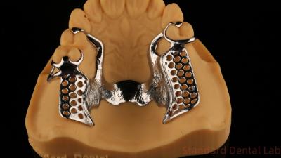 China Metal Alloys Partial Cobalt Chrome Dentures Ivoclar Scheftner Comfortable China Dental Lab for sale