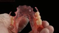 China Ace Teeth Pink/Dark TCS Valplast Flexible Partial Dentures for High Esthetics Dental 3D Print Model for sale