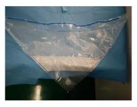 China Waterproof Fluid Collection Bag, Sterilization Pouches Customized Packing for sale