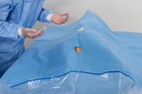 China Gynecological Disposable Surgical Drapes Sterile Gyn Liquid Collection Pouch for sale
