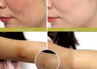 China Damaged Skin Exfoliating Face Scrub , Acne Exfoliating Scrub Refreshing Elasticity Retain for sale