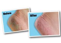 China Unique Formula Design Hand And Foot Cream Products Vitamin E Absorbed Fast for sale