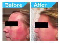 China Relief Vibrance Face Cream Anti Inflammatory External Rapidly Absorbed Multifunctional for sale