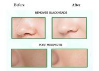 China Refined Texture Skin Care Peel Off Mask , Pore Peel Off Mask Non Impurities for sale