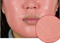 China Natural Material Dead Sea Face Mask Deep Cleansing Beauty Pore Reducing for sale