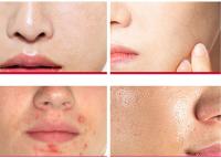 China Natural Material Dead Sea Face Mask Deep Cleansing Beauty Pore Reducing for sale