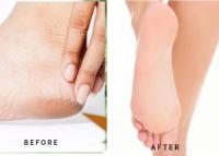China Soothes Hand And Foot Cream Products High Effective Repairing Relieving Skin for sale