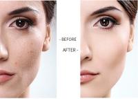 China Acne Prone Tinted Face Moisturizer , Anti Aging Tinted Moisturizer 50ml Non Toxic for sale