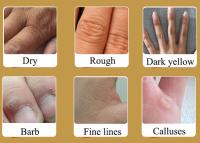 China Oat Fairness Cream For Hands And Feet Rescuer Skin Protective Treatment for sale