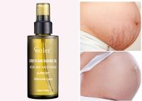 China Age Spots Scars Maternity Skin Care , Pregnancy Mark Cream Harmless Formula for sale