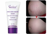 China Smooth Pregnancy Beauty Products Decrease Stretch Marks Prevention Healthy for sale