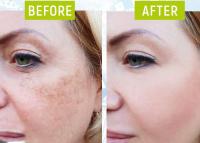 China Oil Control Night Moisturizer Cream Anti Wrinkle Revitalizing Rejuvenates Smooth Tender for sale