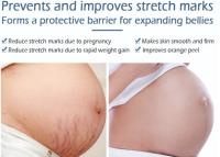 China Scar Remover Maternity Skin Care , Pregnancy Body Moisturiser Clinically Proven for sale