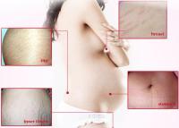 China Revitalizing Maternity Skin Care , Maternity Stretch Mark Cream For Sensitive Skin for sale