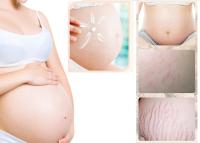 China Revitalizing Maternity Skin Care , Maternity Stretch Mark Cream For Sensitive Skin for sale