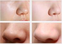 China Anti Acne Face Cleanser Skin Care Tea Tree Renewal 100ml Volume Impurities Removing for sale