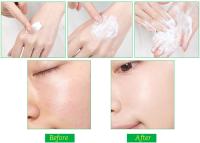 China Anti Inflammatory Face Cleanser Skin Care High Potent Tea Tree Leaf Extract  With Aqua Gel for sale