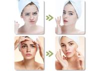 China Anti Inflammatory Face Cleanser Skin Care High Potent Tea Tree Leaf Extract  With Aqua Gel for sale