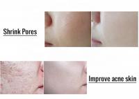 China Botanical  Vitamin E Serum For Skin Gentle Revive Balance Tone Promote Collagen Production for sale