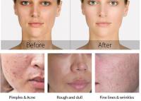 China Hearb Extract Chemical Free Face Serum Activity Components Pesticide Free Quick Absorbing for sale