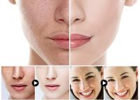China Nourishing Natural Face Serum For Oily Skin High Concentration Anti Bacterial for sale