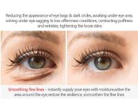 China Hyaluronic Acid Nourishing Eye Cream Enhances Circulation Diminish Fine Lines for sale