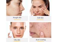 China Anti Acne Gentle Face Exfoliator Alcohol Free 200ml Volumewith OEM ODM Service for sale