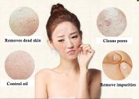 China Professional Exfoliating Face Scrub , Exfoliating Gel Scrub Gentle Reducing Inflammation for sale