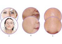 China Beauty Face Brightening Serum Pore Reducer Hyperpigmentation Treatment Health for sale