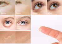 China Hyaluronic Acid Nourishing Eye Cream Enhances Circulation Diminish Fine Lines for sale