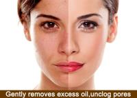 China Facial Cleanser , Total Effects Nourishing & Hydrating Face Cream | For All Skin Types for sale