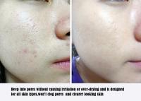 China Hypoallergenic Skin - Purifying Astringent Face Toner To Cleanse 120ml ODM for sale