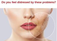 China Balancing Toner Alcohol - Free Astringent Skin Care Pore Minimizer & Calming Skin Treatment for sale