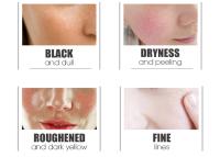 China Age Defense Face Cream Natural Facial Moisturizer Cusomized Odor for sale