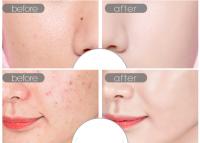 China Age Defense Face Cream Natural Facial Moisturizer Cusomized Odor for sale