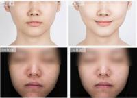 China Anti Aging Instant Brightening Hydrating Face Sheet Mask for sale