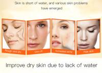 China Moisturizing Oil Eliminating Pore Refining Toner Skin Care For Acne Prone for sale