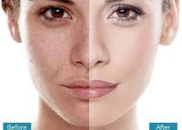 China Face And Neck Anti Aging Night Moisturizer Cream Reduce Wrinkles for sale